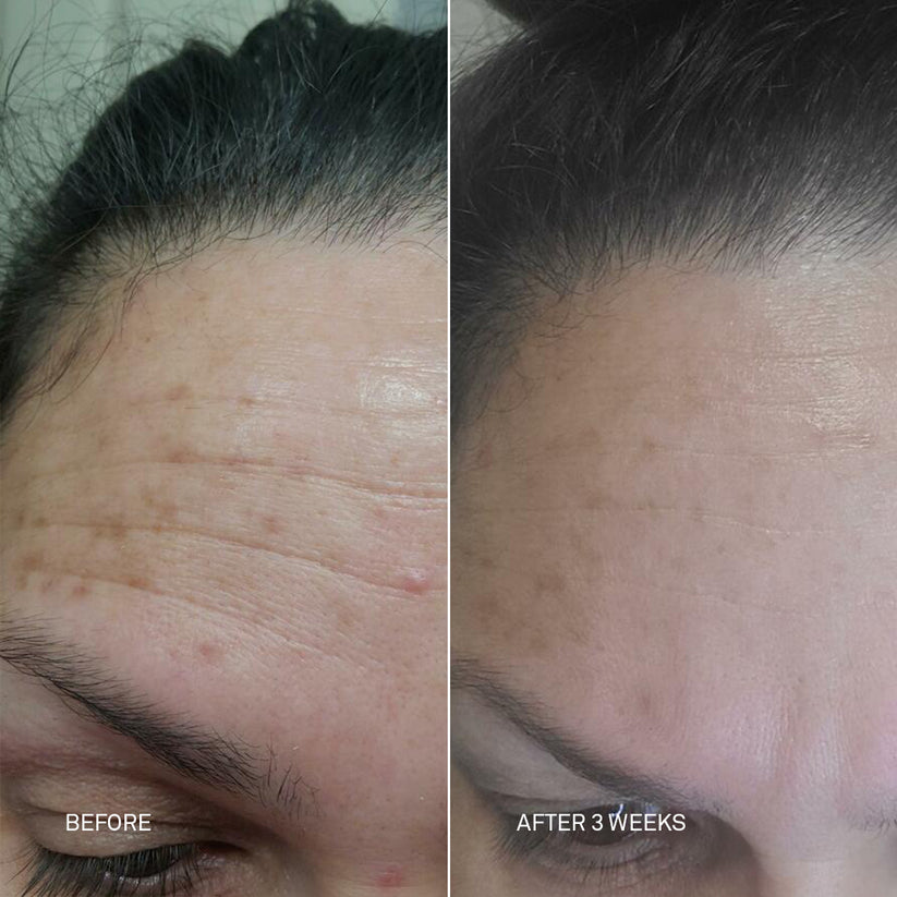 DNA Repair Complex Skin Damage and Scar Treatment | RescueMD