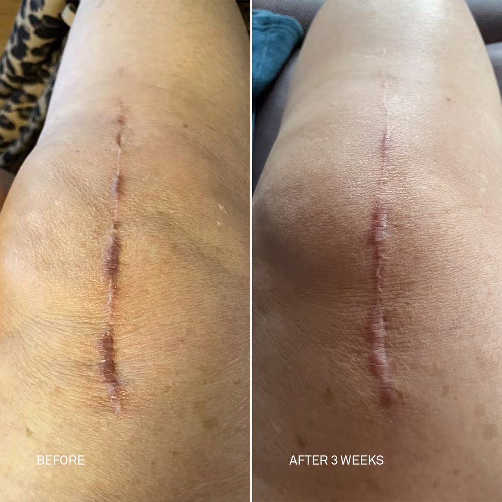 DNA Repair Complex PRO Skin Damage and Scar Treatment | RescueMD