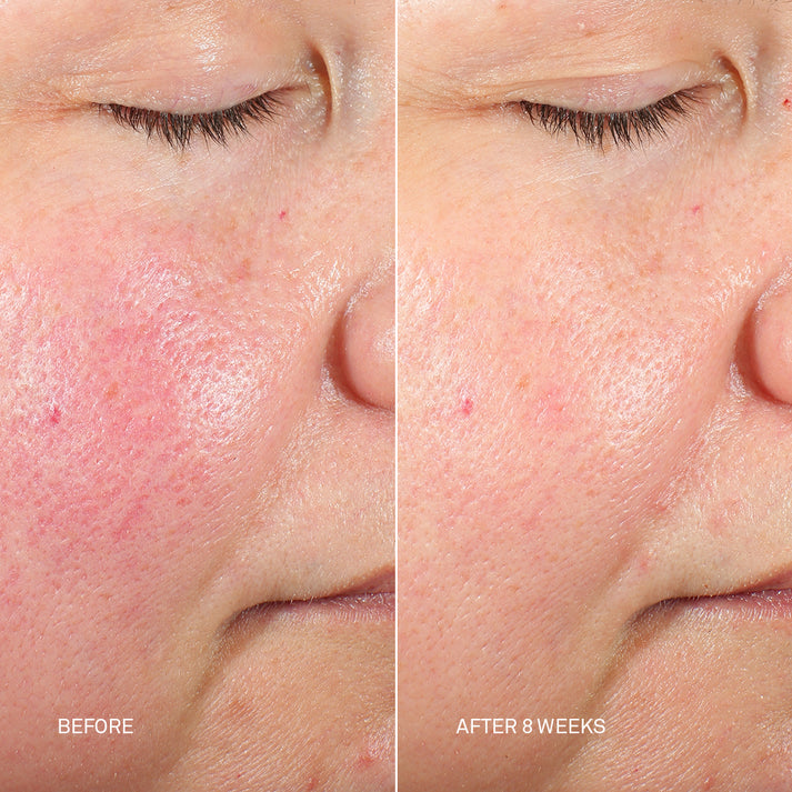 DNA Repair Complex PRO Skin Damage and Scar Treatment | RescueMD